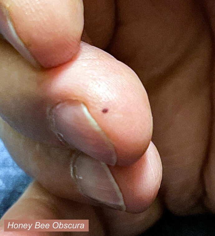 Honey Bee Stings | Bee Culture
